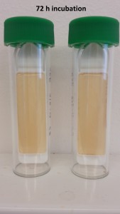 Are you interpreting your dip slide correctly?