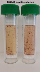 Are you interpreting your dip slide correctly?